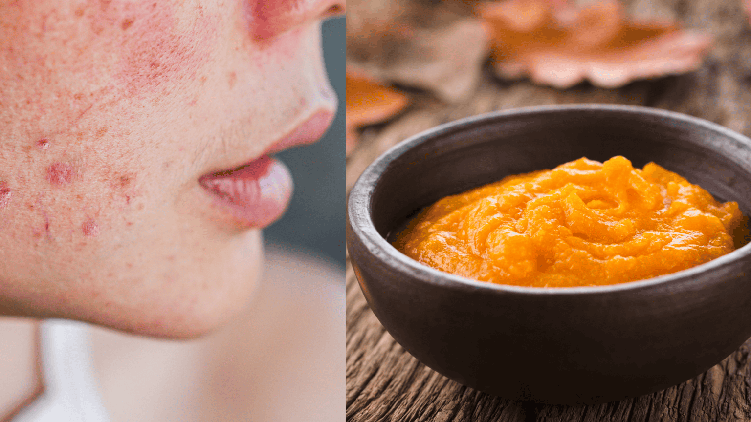 How To Use Pumpkin For Beautiful Glowing Skin! | A Green Beauty Blog